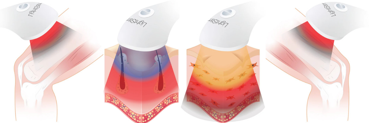 LightStim Home Care Devices – Heidi Lavan Esthetics